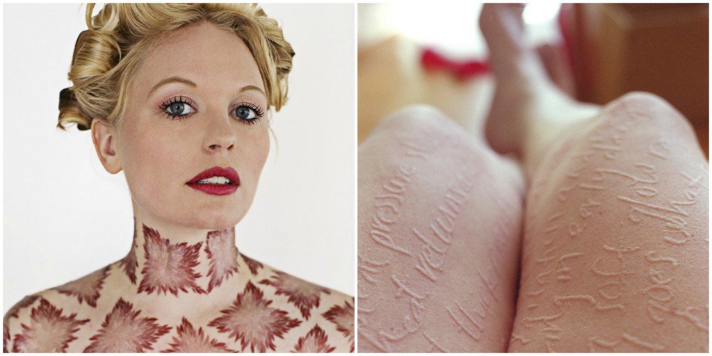 Photographer Captures Her "Skin Writing" Condition In A Series Of ...